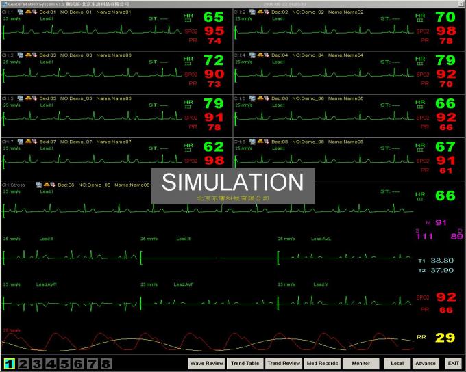 central monitoring system of Portable bedside Patient Monitor